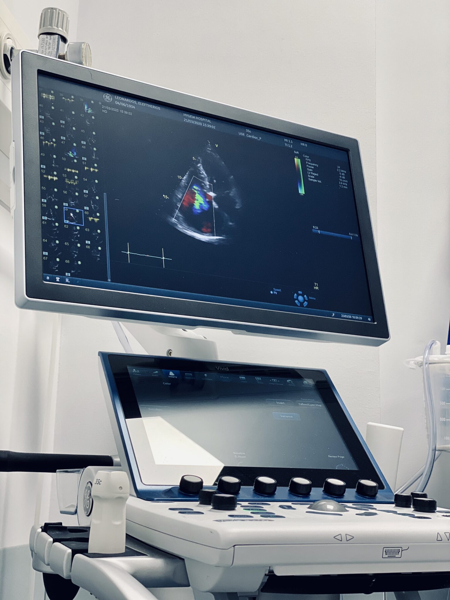 Έγχρωμο Τρίπλεξ Καρδιάς - Νικόλαος Καραμιχαλάκης, Καρδιολόγος, Αθήνα ...